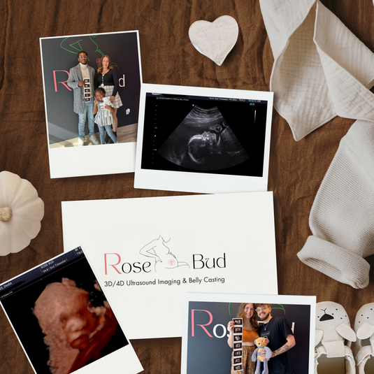 Rose Bud Imaging 2D/3D/4D Ultrasound & Belly Casting